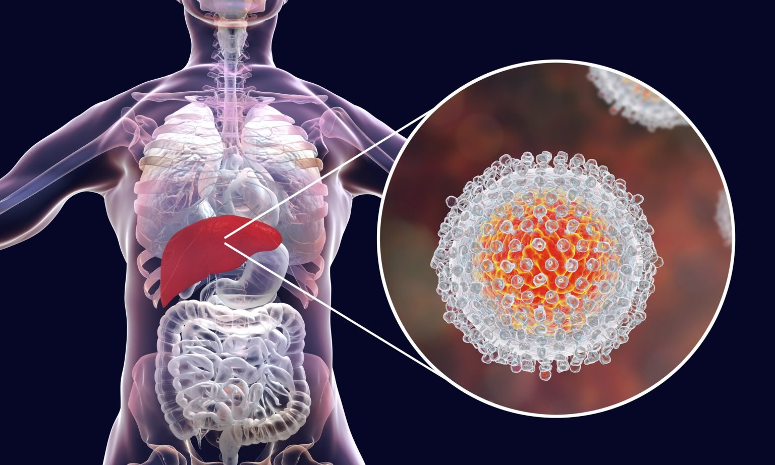 PCR Hepatitis C (Polymerase chain reaction)
