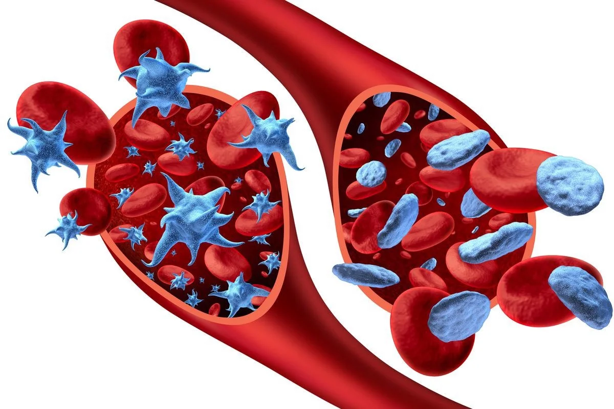 Platelet count (PLT)