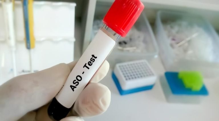 Antistreptolysin O Titer (ASO)