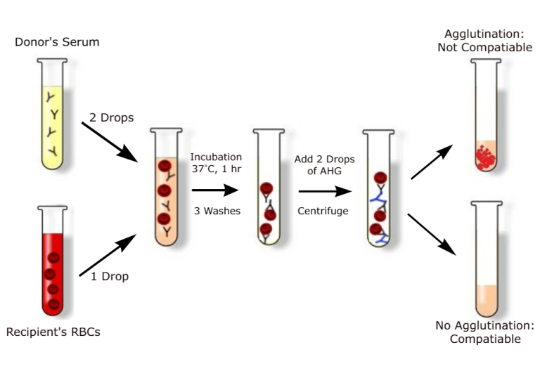 Blood Group and Crossmatch