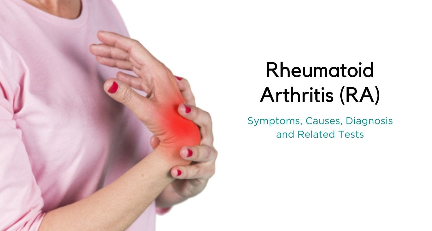 Rheumatoid Factor RA Factor