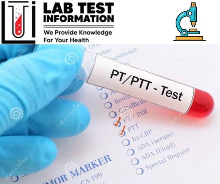 APTT Blood Test Purpose Procedure Lab Test Information