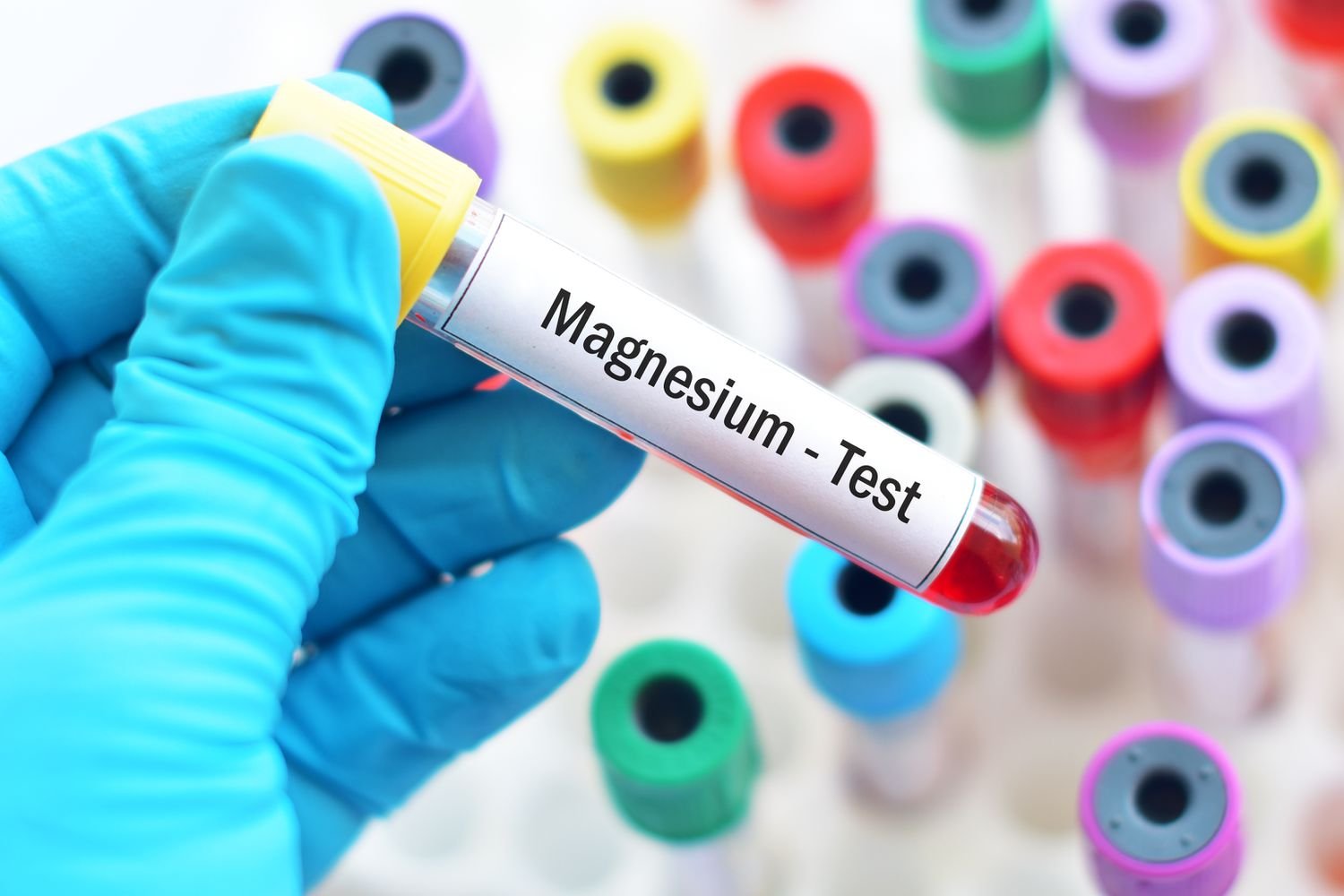 Magnesium Blood Test Purpose Procedure Results Risk LTI Magnesium Blood Test Purpose Procedure Results Risk LTI