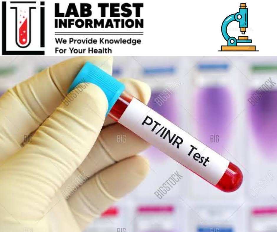 Prothrombin Time PT Purpose Result Lab Test Information