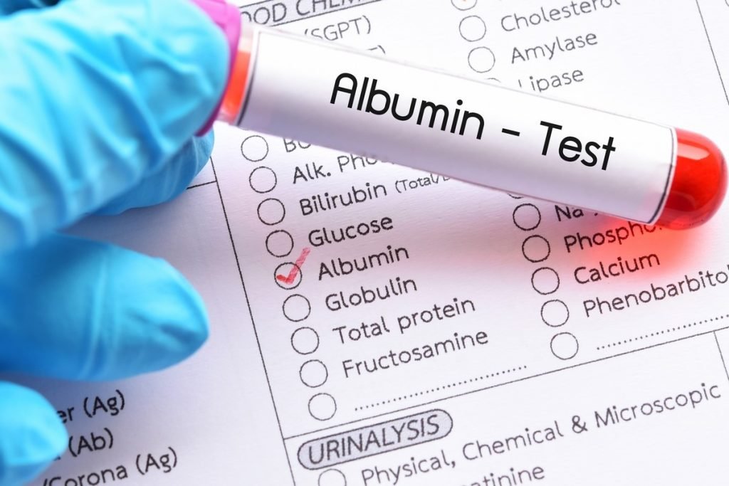 Serum Albumin