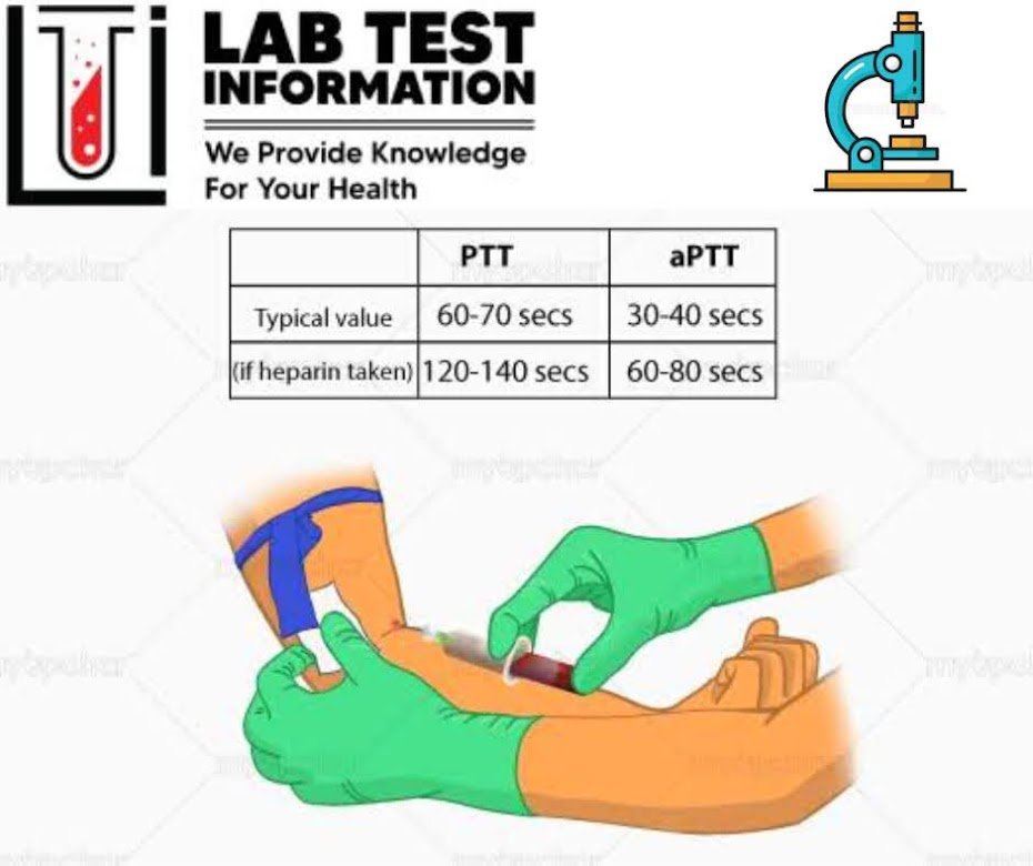 APTT Blood Test Purpose Procedure Lab Test Information