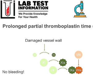 APTT Blood Test Purpose, Procedure, | Lab Test Information