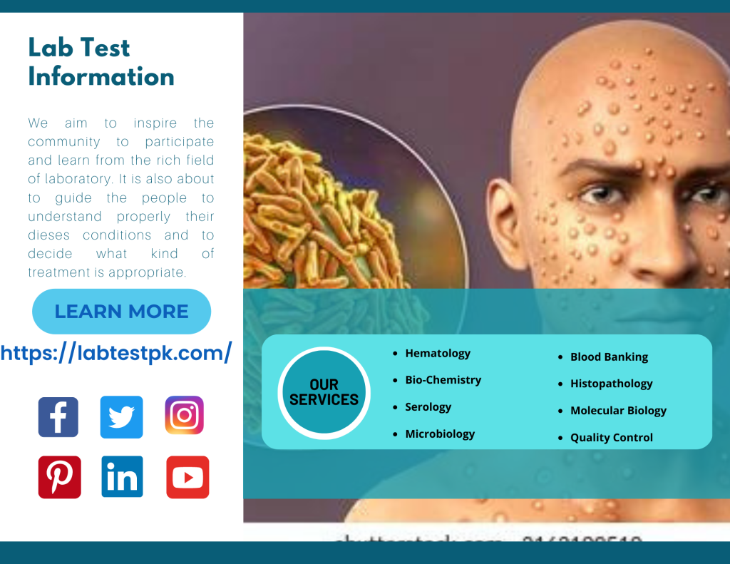 Smallpox Disease Diagnose, Treatment| Lab Test Information