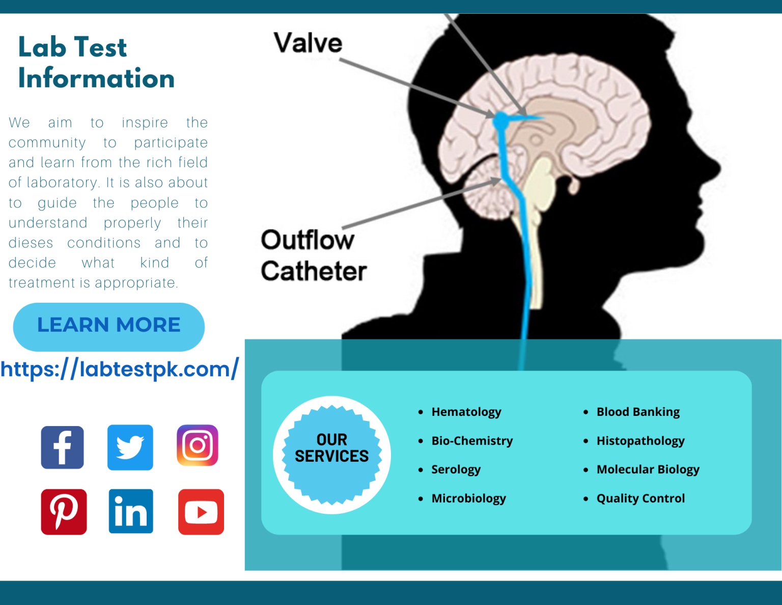 Cerebrospinal fluid CSF