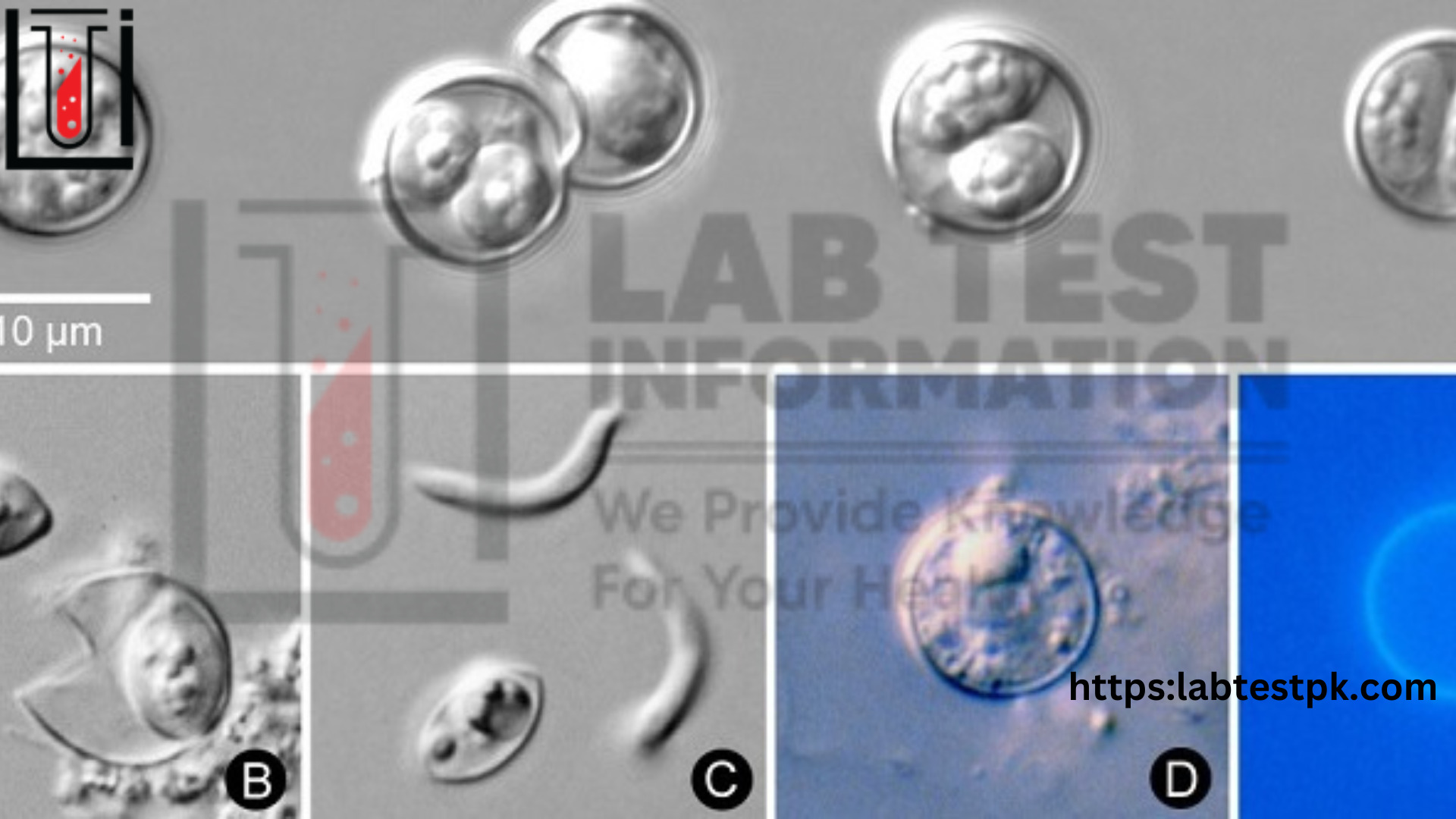 Cyclosporiasis Disease