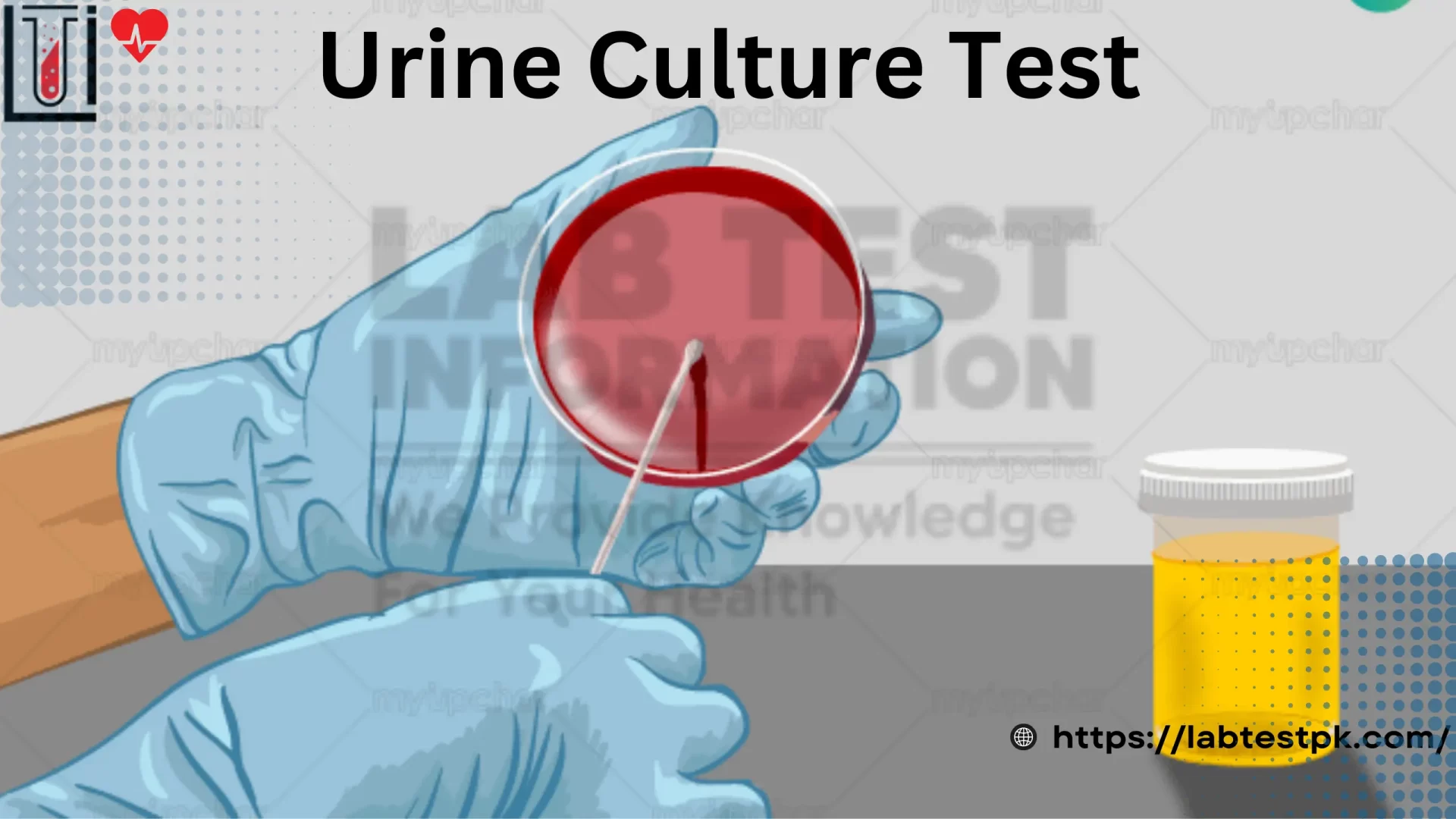 Urine Culture Test Urine Culture Test