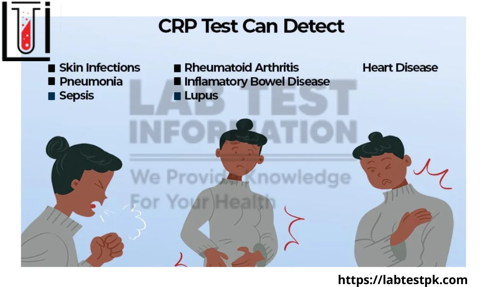 C reactive Protein CRP Symptoms Lab Test Information